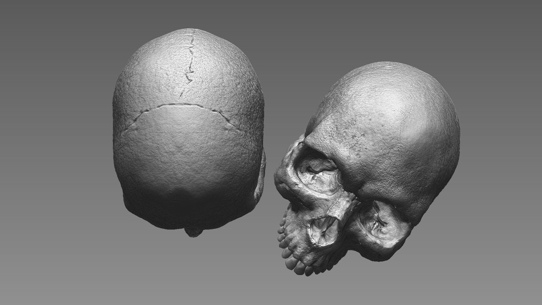ArtStation - Human Realistic Skull | High Poly | Resources