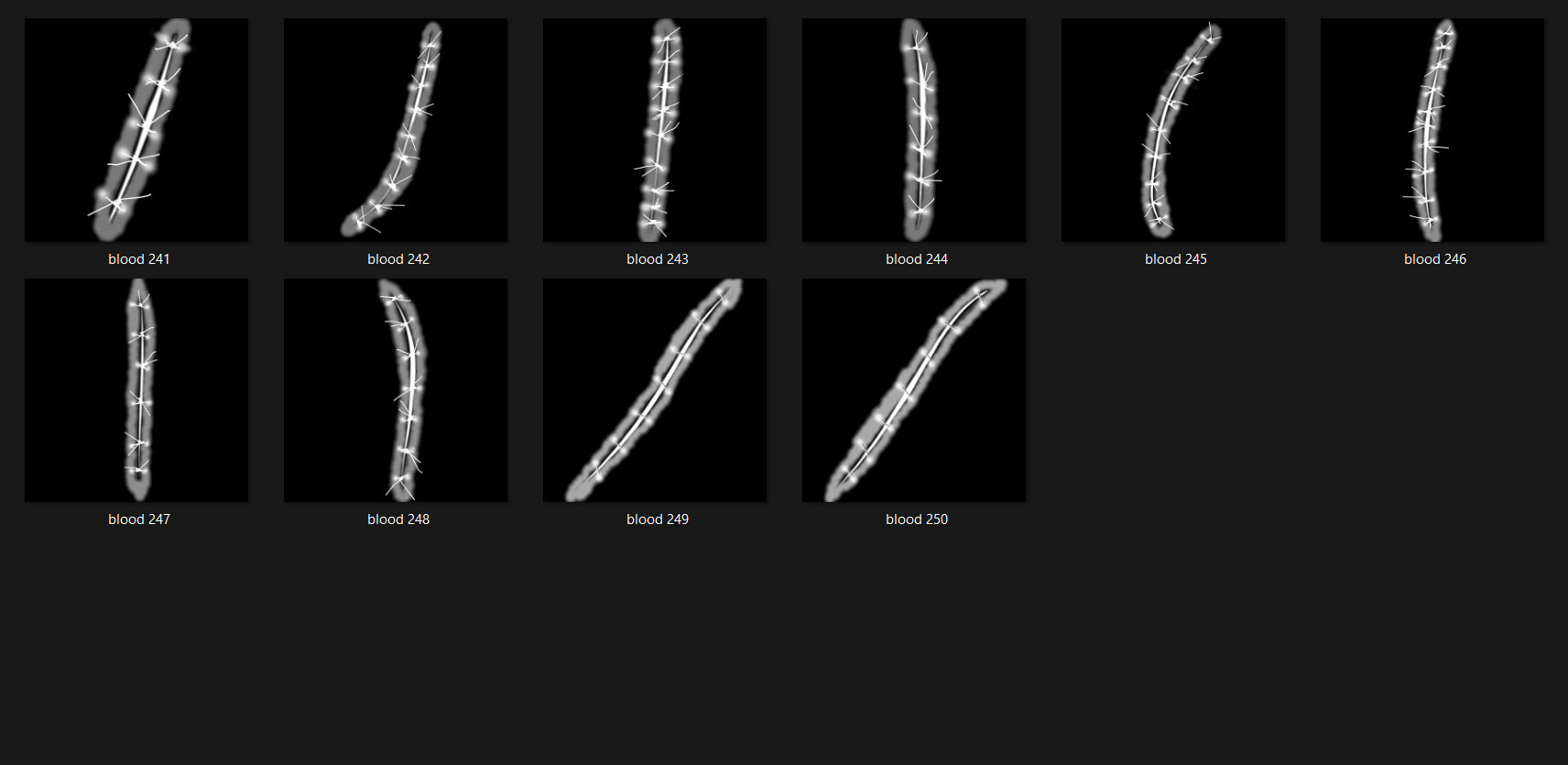 ArtStation - Blood 300 Alpha Patterns 2K Size Full Pack | Brushes