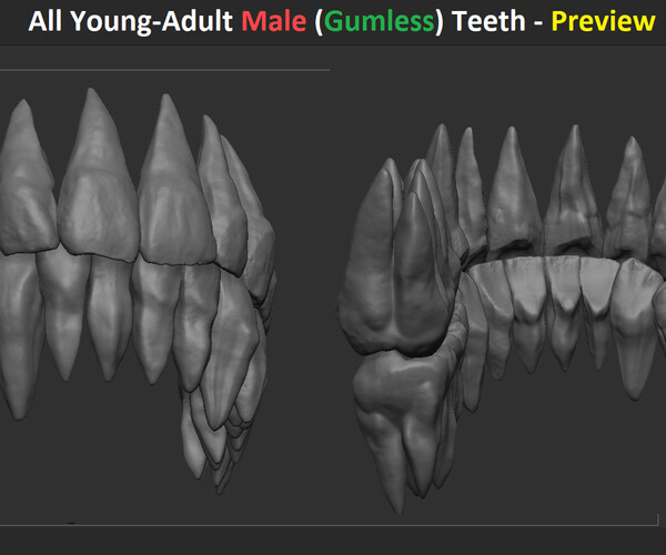 ArtStation - Dentist-Grade Human Teeth Scans - (Young-Adult Male ...